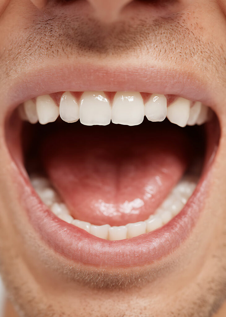 Glossectomy – Advanced ENT Care