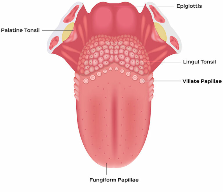 Glossectomy – Advanced ENT Care